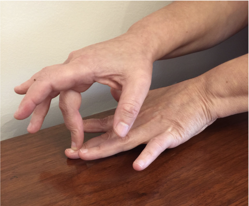 Abdomen – Percussion – Introduction to Health Assessment for the ...