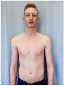 Posterior and Lateral Thorax – Inspection – Introduction to Health ...
