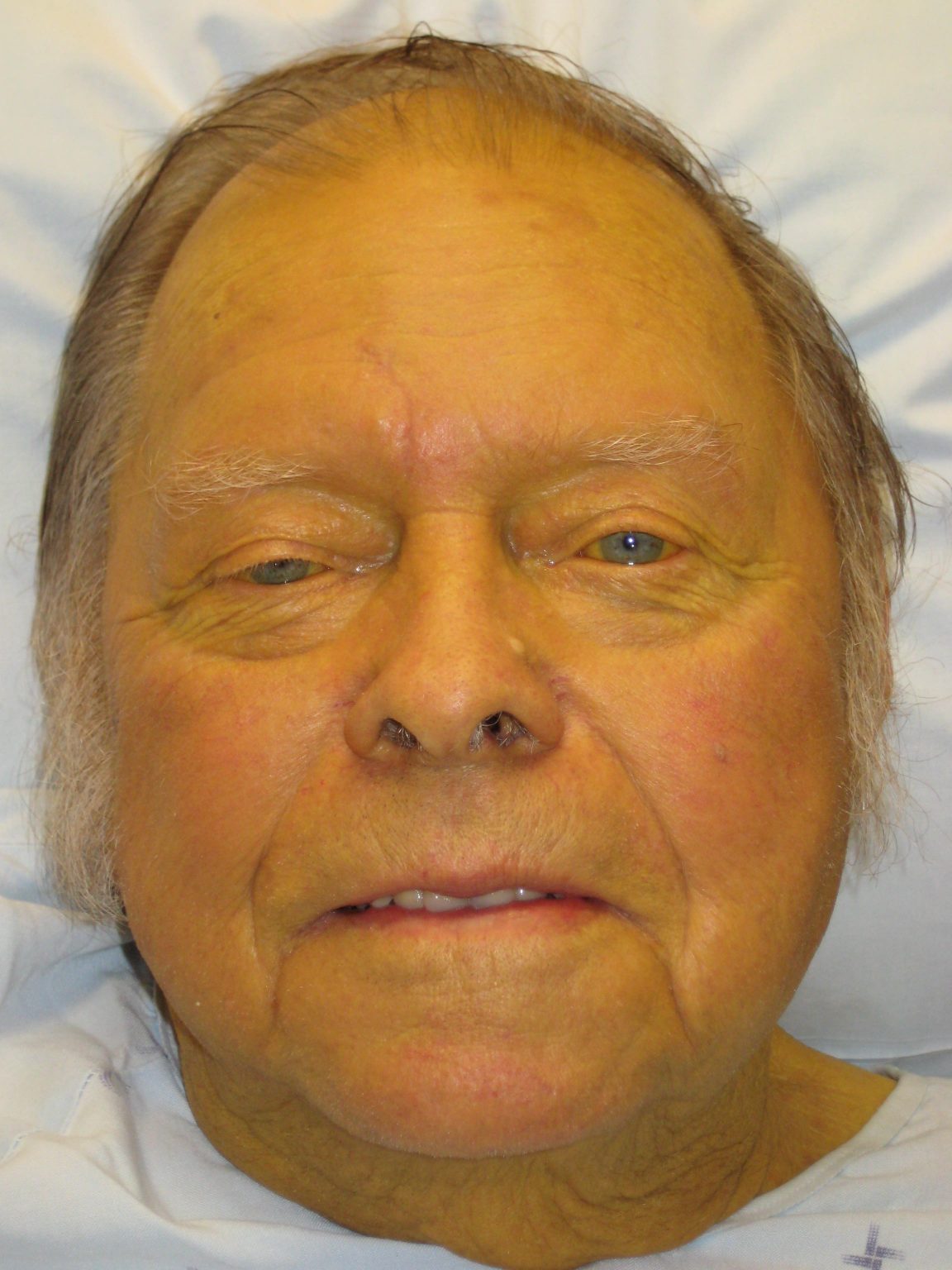 Skin: Inspection – Introduction to Health Assessment for the Nursing ...