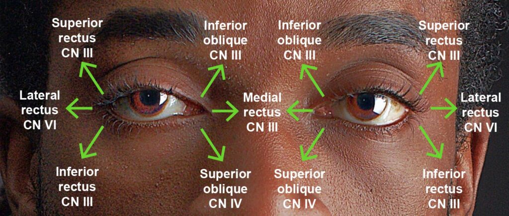 CN III, IV, and VI – Oculomotor, Trochlear, and Abducens Nerves ...