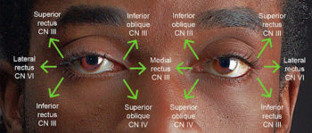Extraocular Eye Movement – Introduction to Health Assessment for the ...