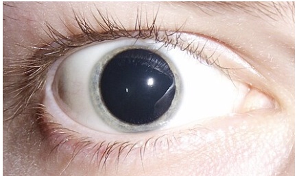 External Eye Assessment and Anterior Eyeball Assessment – Introduction ...