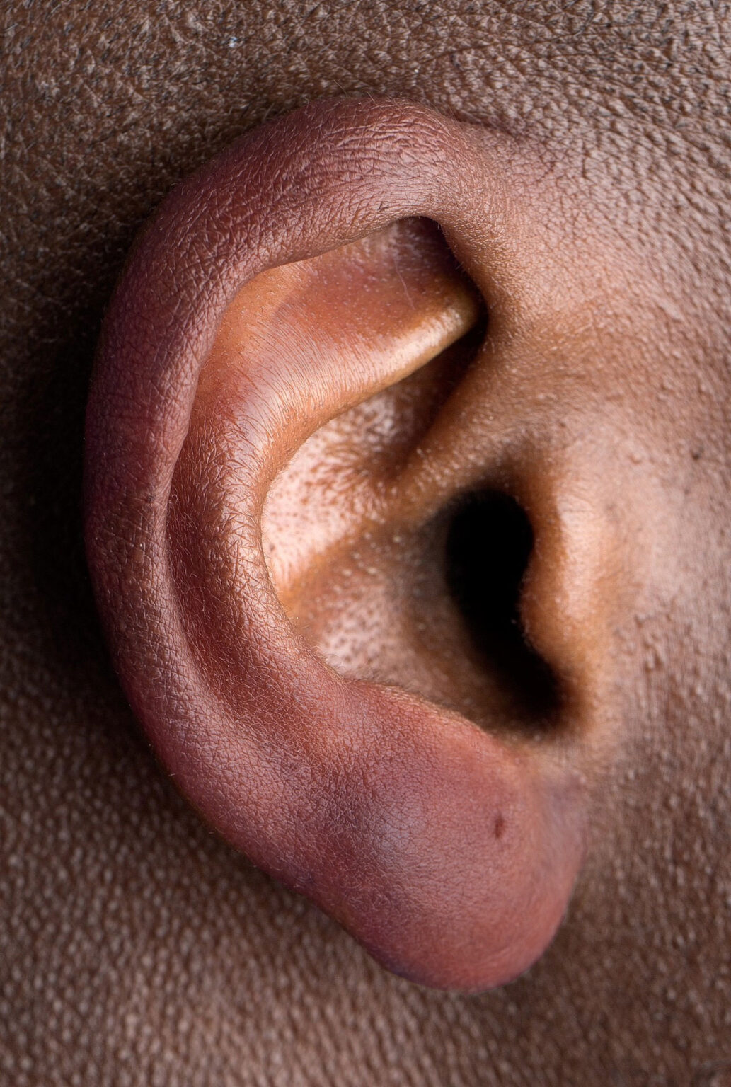 Inspection and Palpation of External Ear – Introduction to Health ...